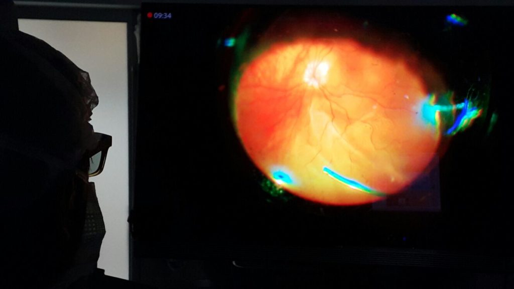 Vitreoretinal Surgery (Retinal Surgery) - Prof. Dr. Kaan Ünlü